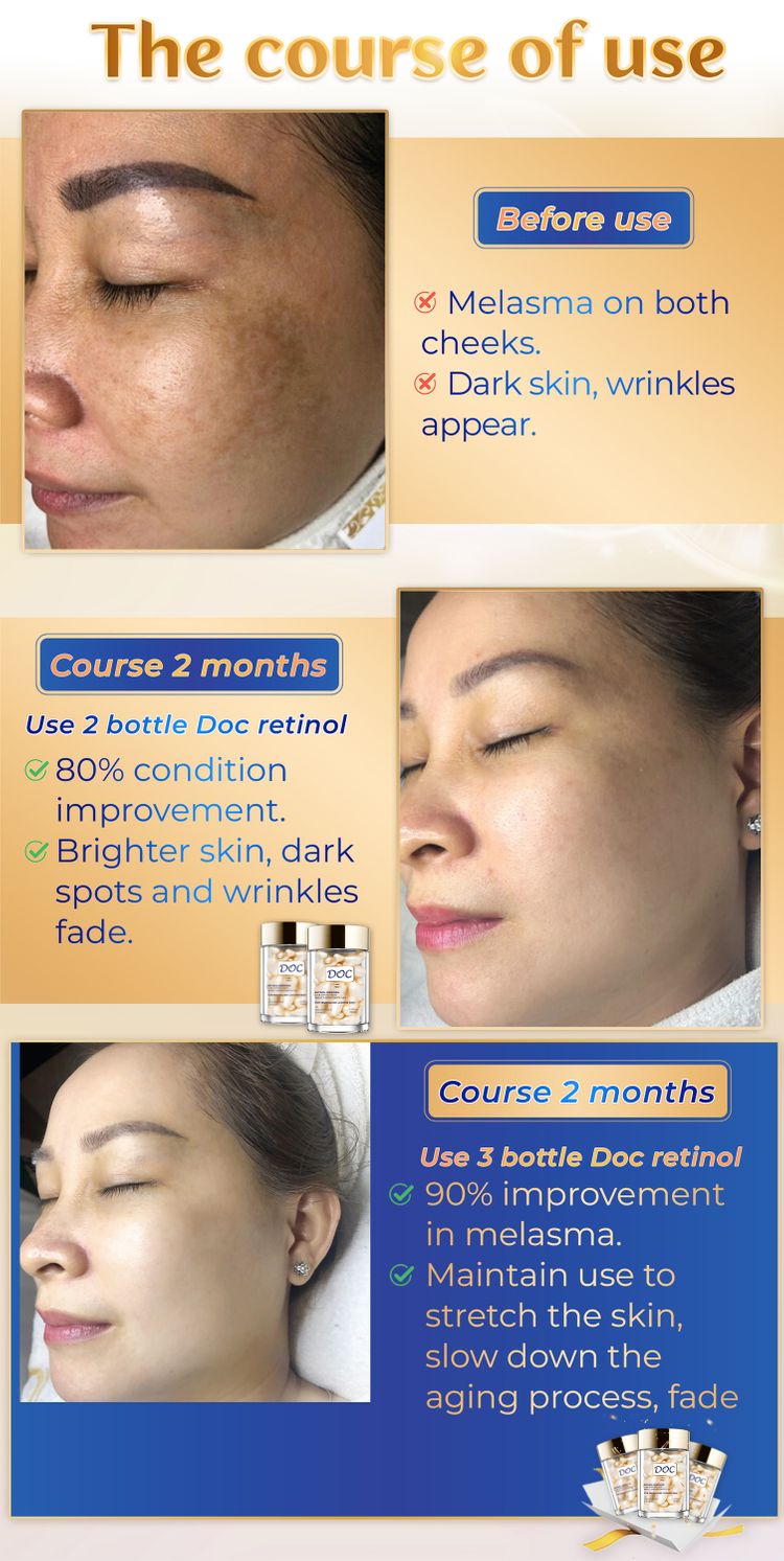 Anti-Wrinkle Firming&Skin Rejuvena Doc Retinol Serum - Rectangulau